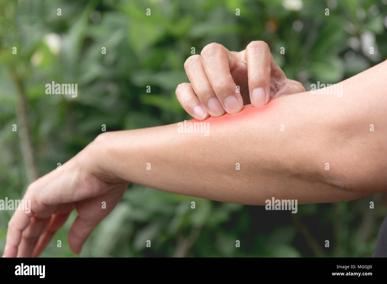 Women scratch itch with hand. Woman scratching her arm healthcare ...