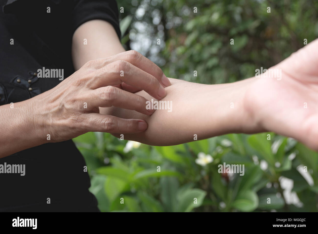 Scratching Arm Stock Photos & Scratching Arm Stock Images - Alamy