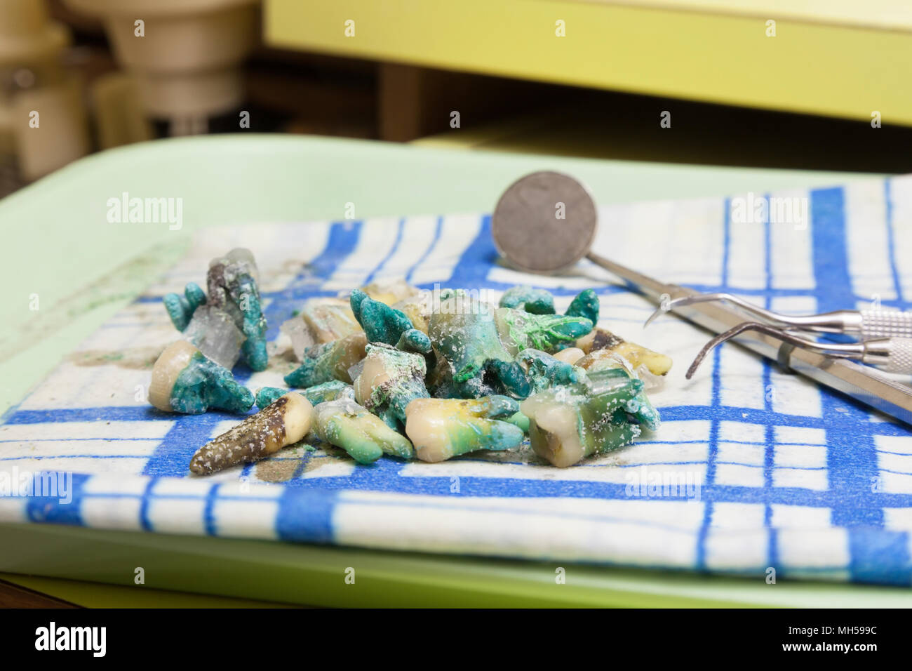 Rotten teeth hi-res stock photography and images - Alamy