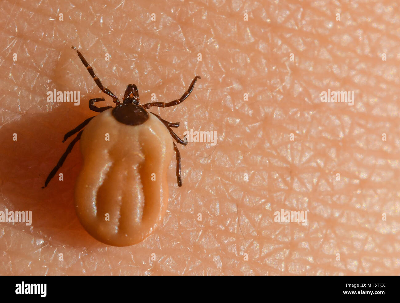 29 April 2018, Germany, Sieversdorf: A saturated tick crawls up the arm ...