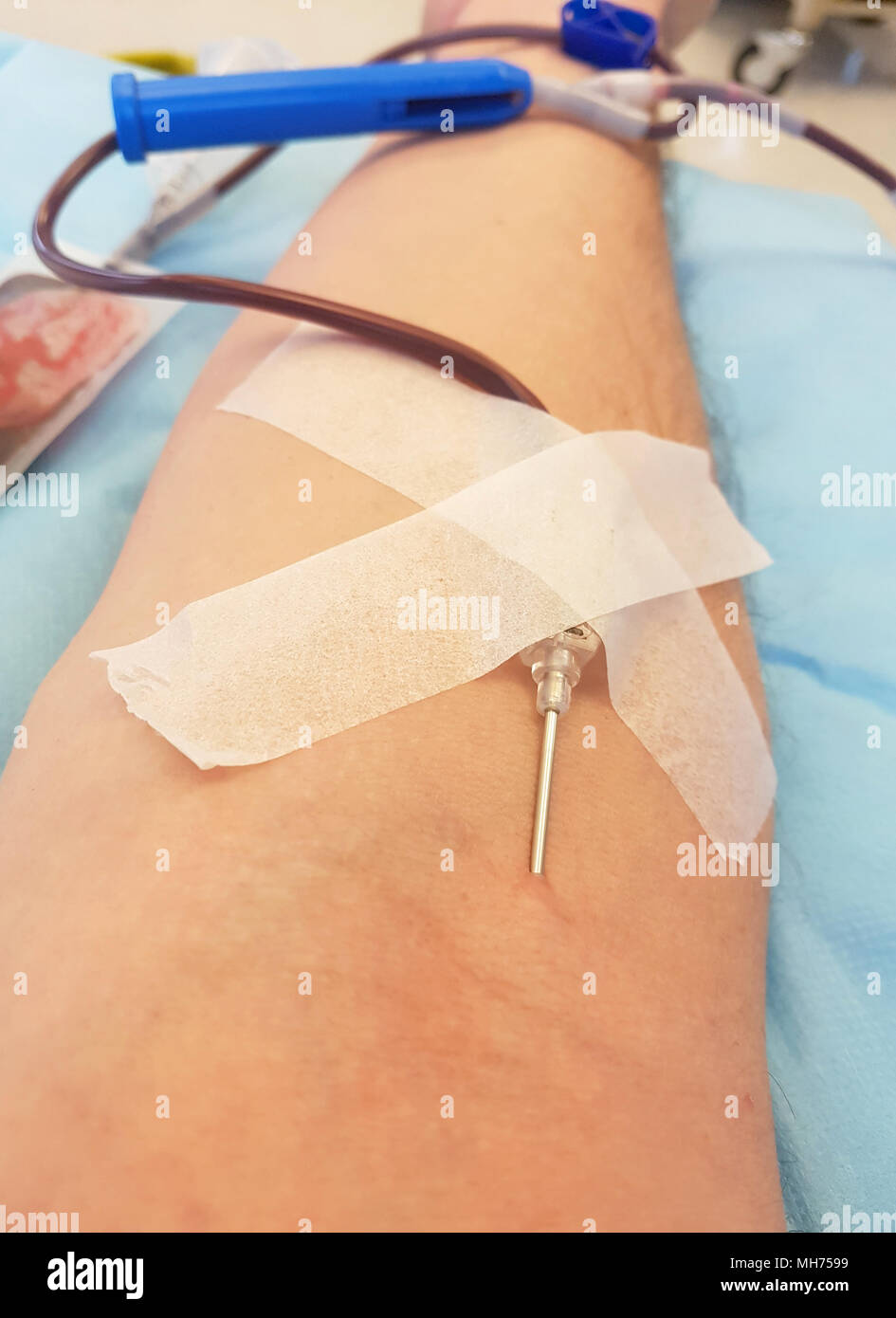 arm of a volunteer during the blood donation at hospital Stock Photo ...