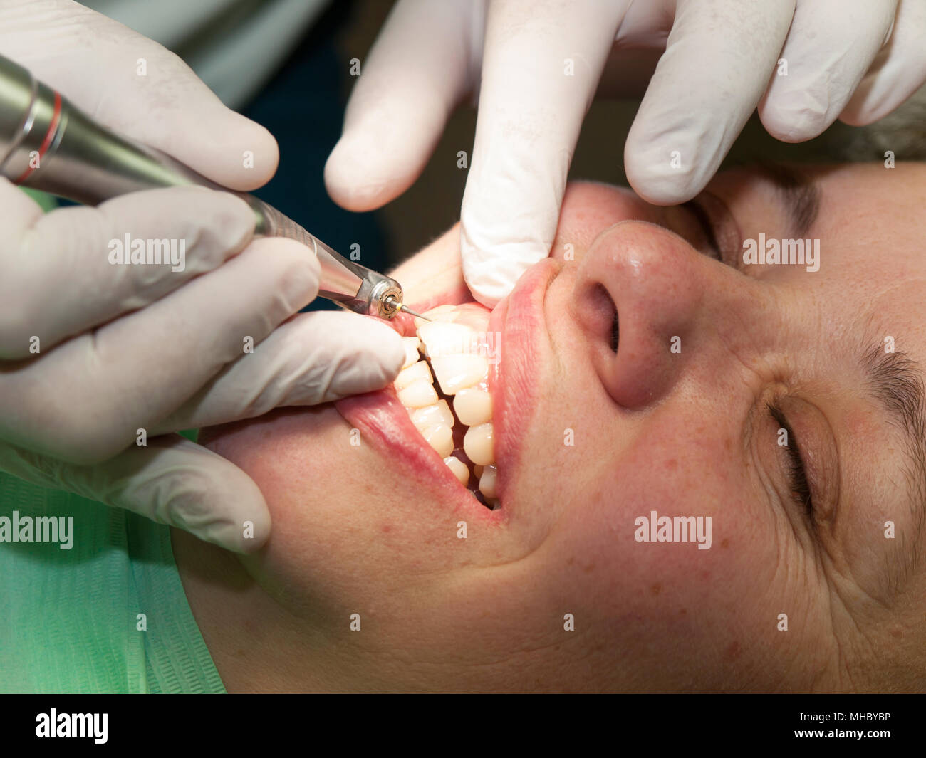Tooth drill hi-res stock photography and images - Alamy
