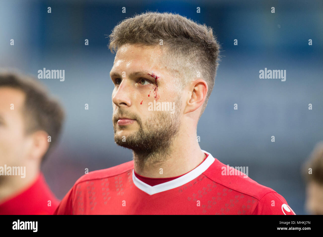 Soccer Football Blood Bleeding High Resolution Stock Photography and ...