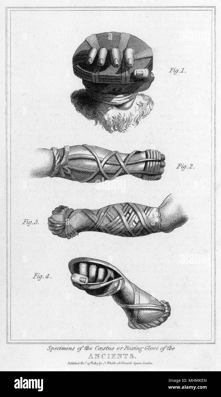 Four versions of the Roman cestus, a leather glove used in ancient ...