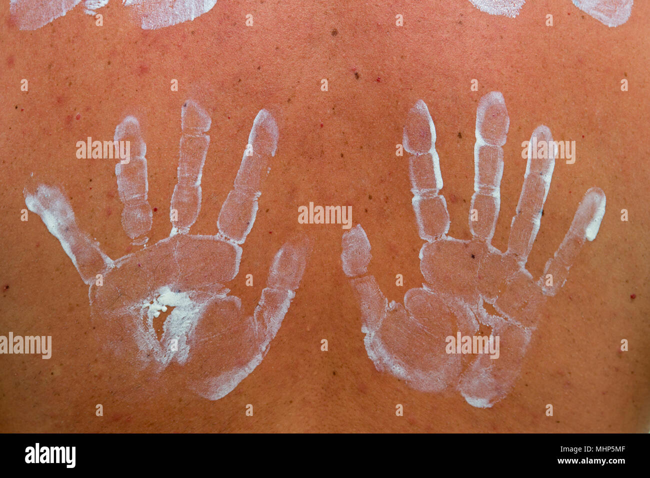 white hands shape on skin detail of sun protector cram Stock Photo - Alamy