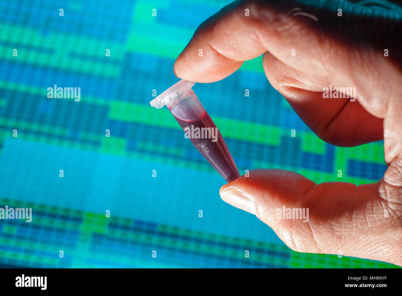 Bio samples for genetic analysis Blood In tube for laboratory analysis ...
