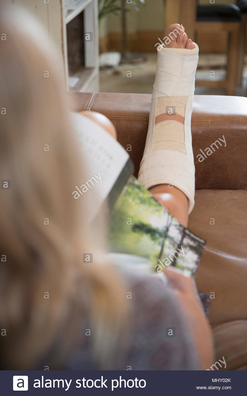 Plaster Cast Leg Stock Photos & Plaster Cast Leg Stock Images - Alamy