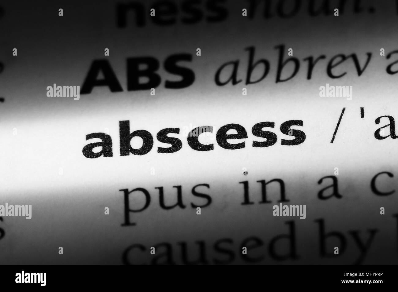 abscess word in a dictionary. abscess concept Stock Photo - Alamy