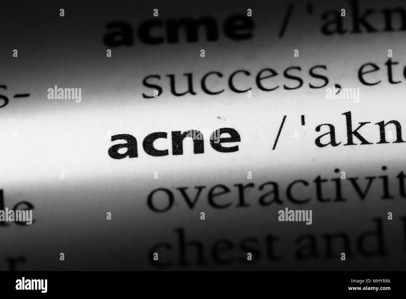 Acne Black and White Stock Photos & Images - Alamy