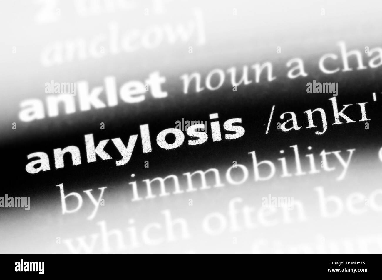 Ankylosis hi-res stock photography and images - Alamy