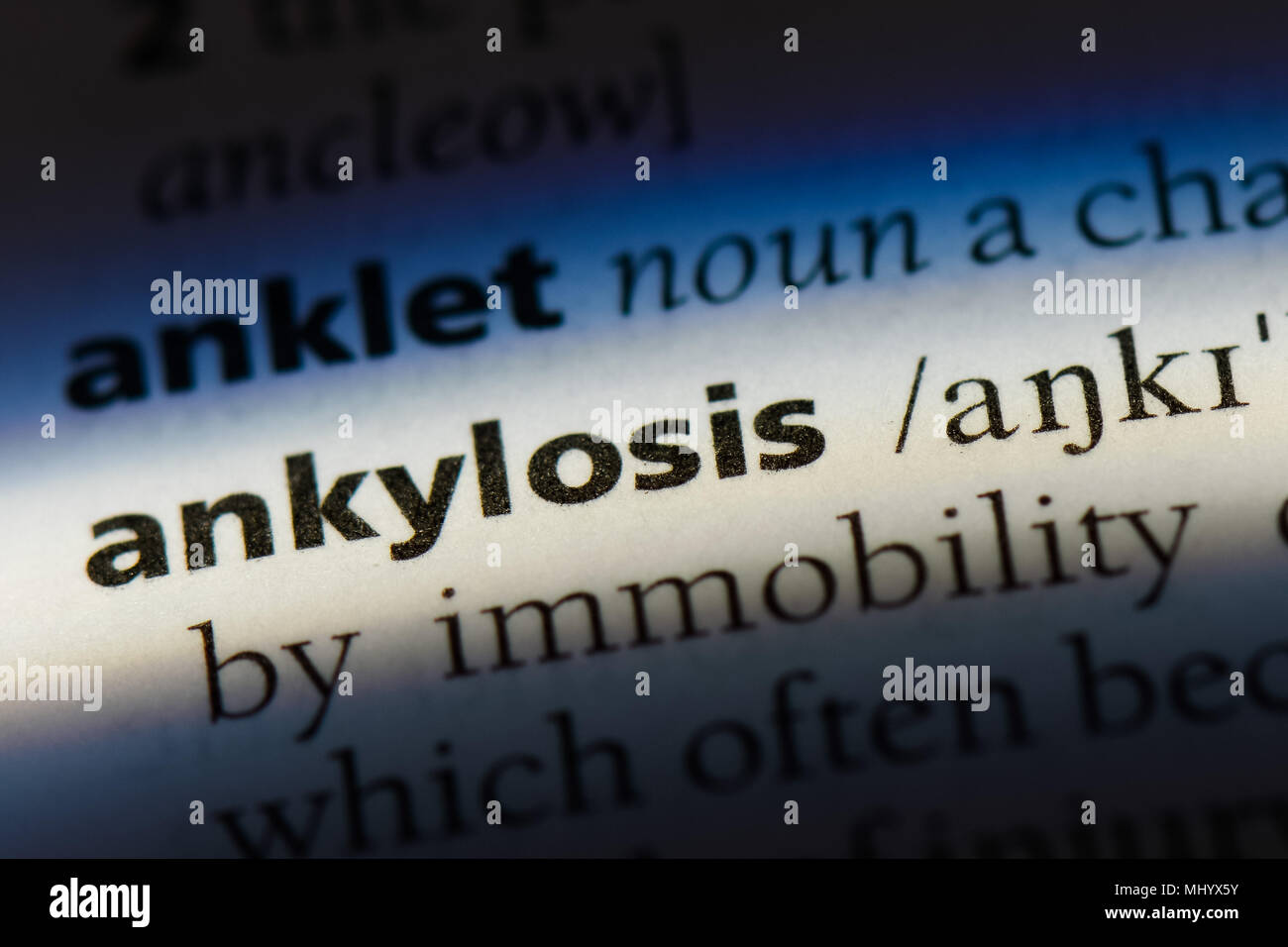 Ankylosis hi-res stock photography and images - Alamy