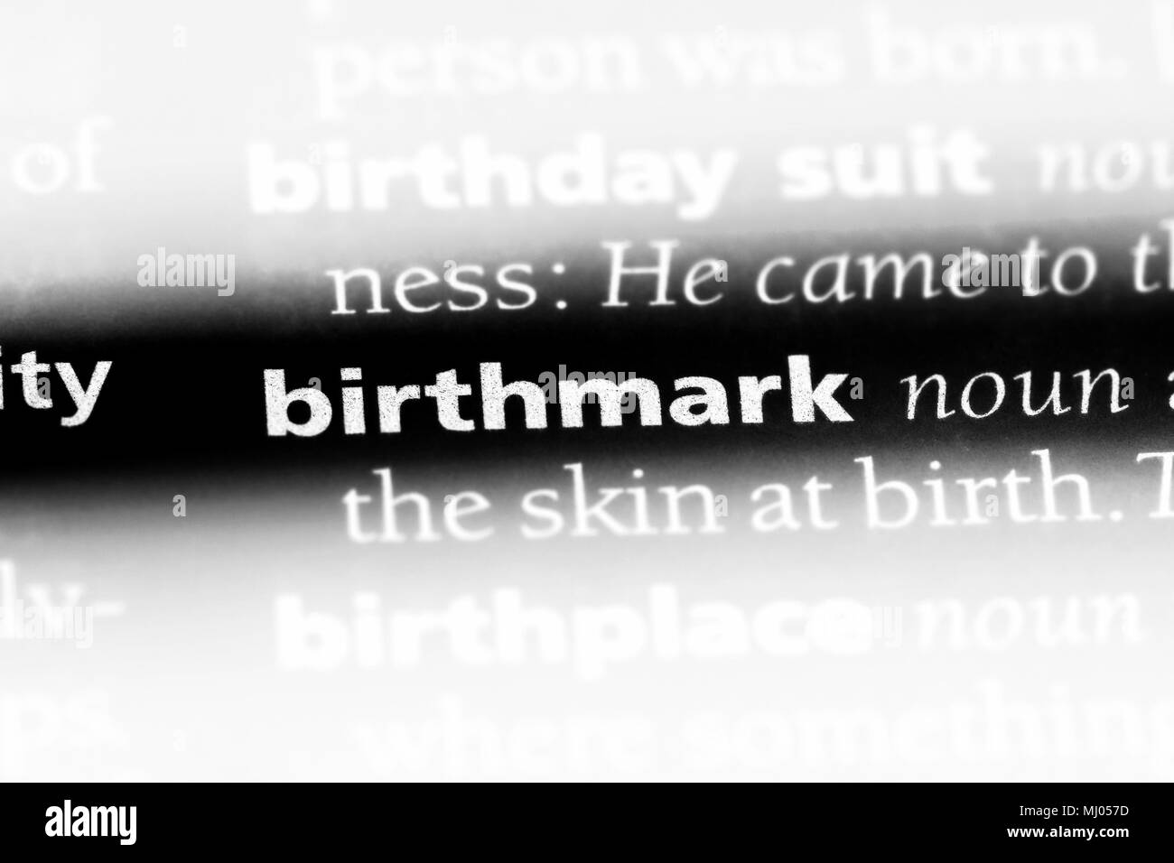 Birthmark birthmark Black and White Stock Photos & Images - Alamy