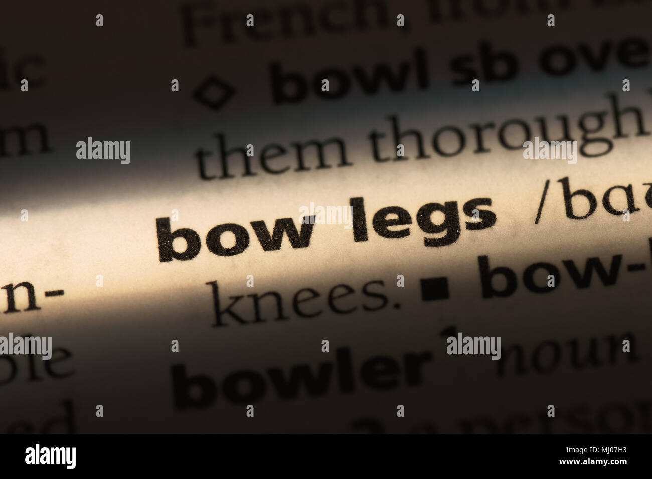bow legs word in a dictionary. bow legs concept Stock Photo - Alamy