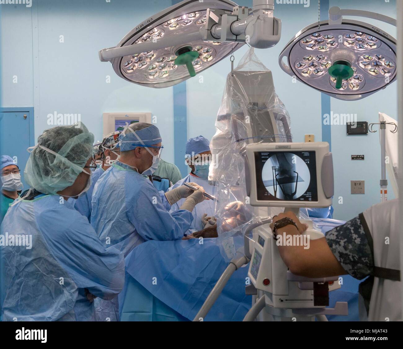 Open reduction internal fixation femur hi-res stock photography and ...