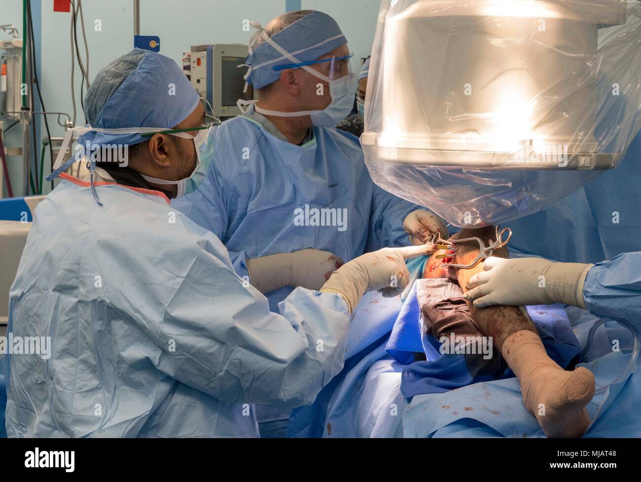 Open reduction internal fixation femur hi-res stock photography and ...