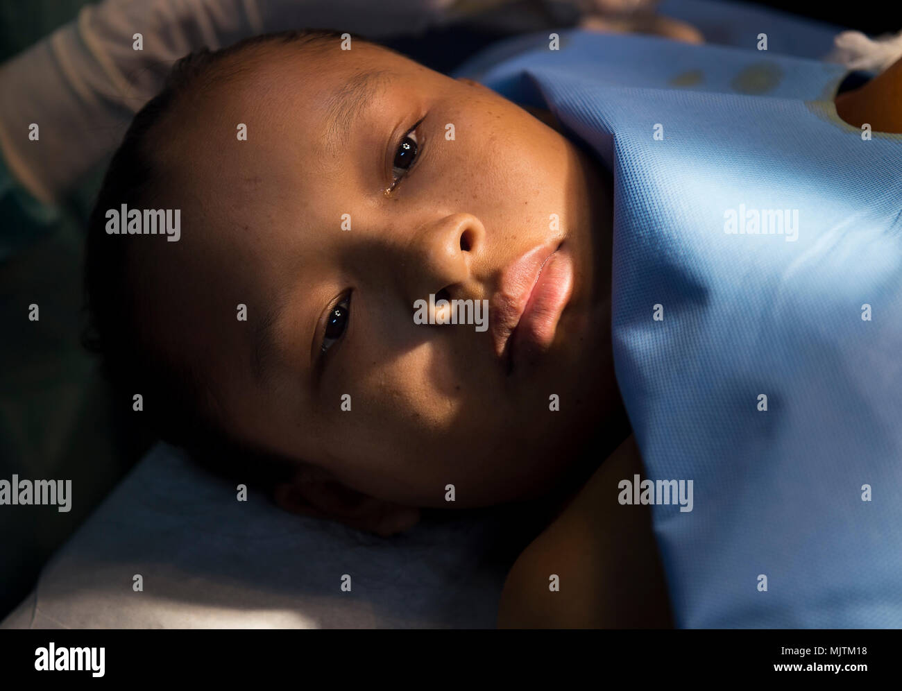 Forest abscess hi-res stock photography and images - Alamy