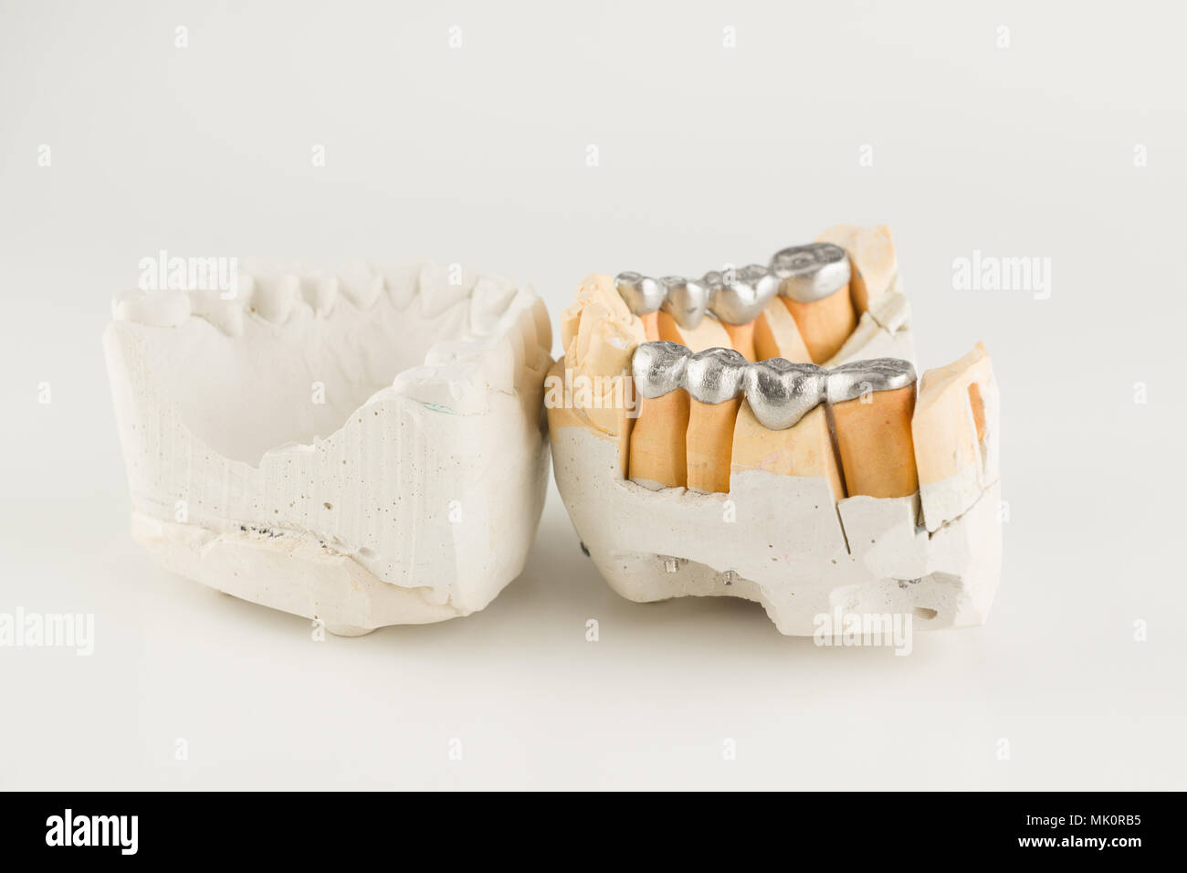 bases of metal-cast bridges on an artificial dental model Stock Photo ...