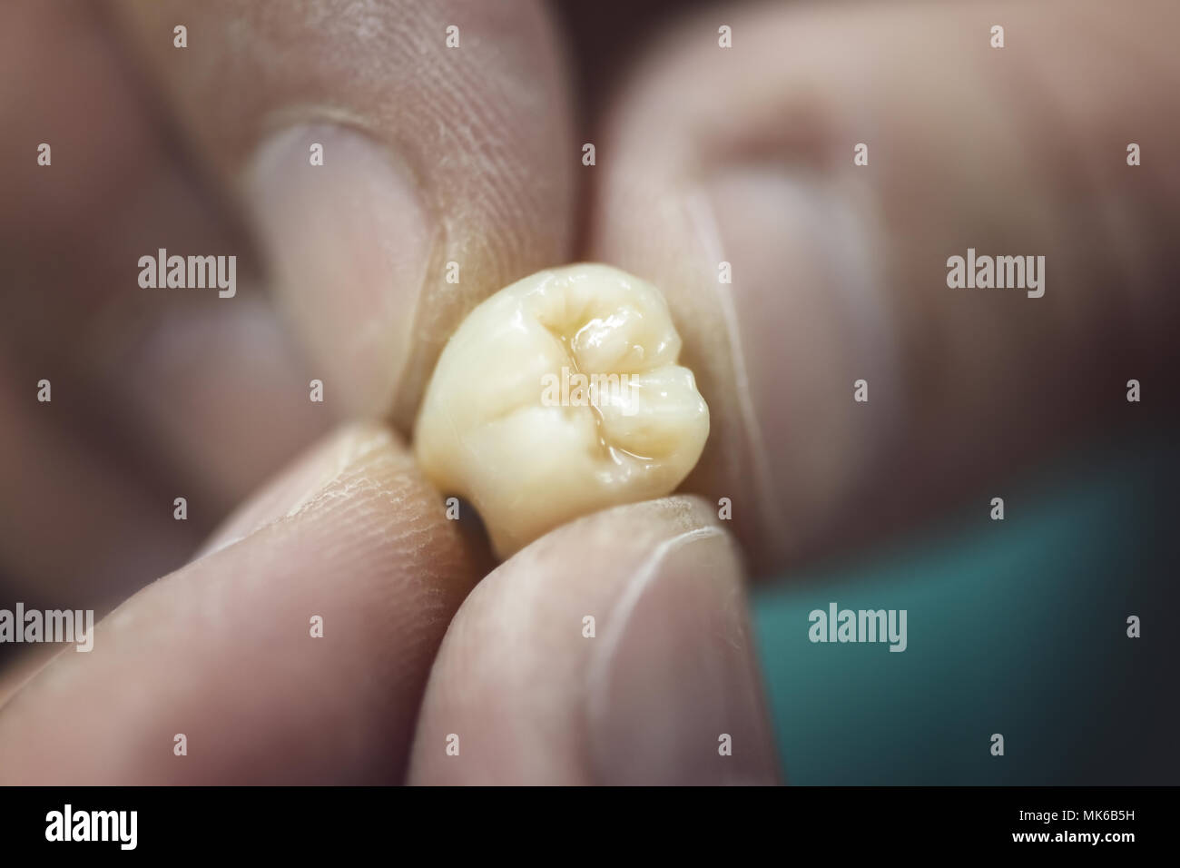 Artificial tooth being done by a dental prosthesis specialist Stock ...
