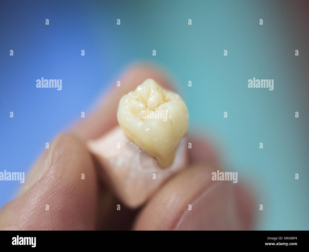 Artificial tooth being done by a dental prosthesis specialist Stock ...