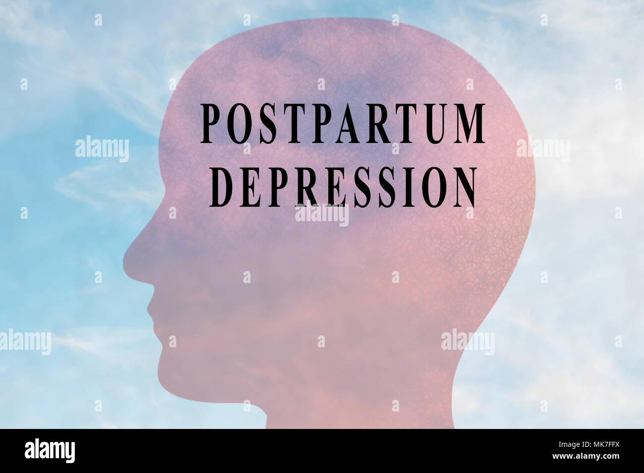 Render illustration of POSTPARTUM DEPRESSION title on head silhouette ...