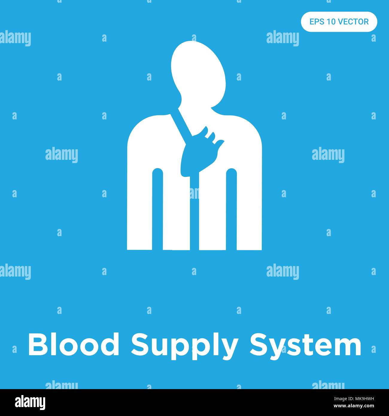 Coronary aneurysm Stock Vector Images - Alamy