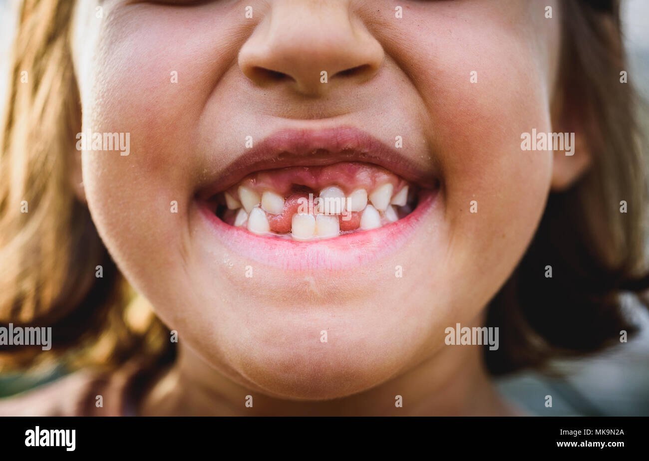 Toothless grin hi-res stock photography and images - Alamy