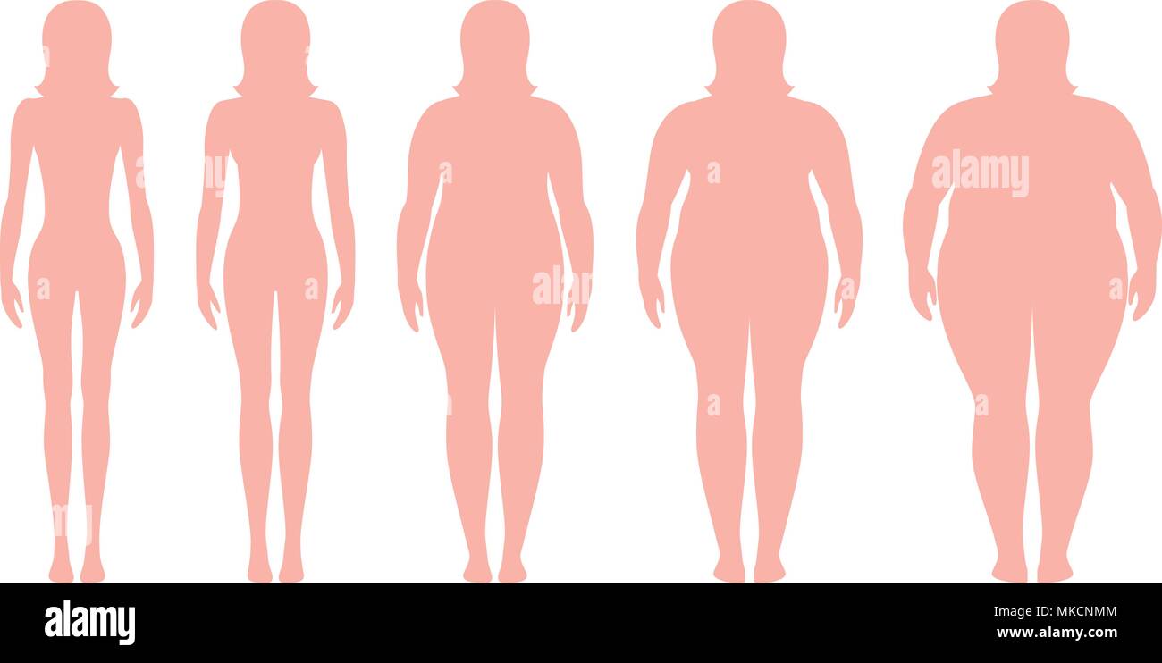 Morbidly obese woman hi-res stock photography and images - Alamy