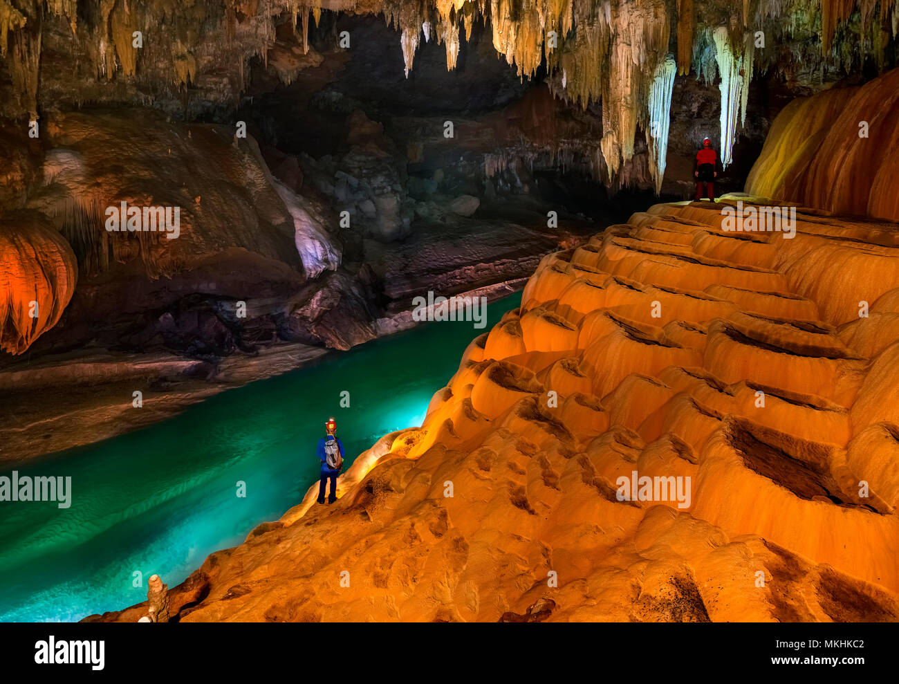 Human concretion hi-res stock photography and images - Alamy