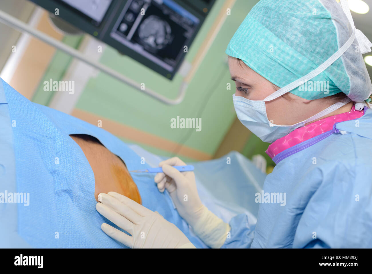 removing a tumor Stock Photo - Alamy