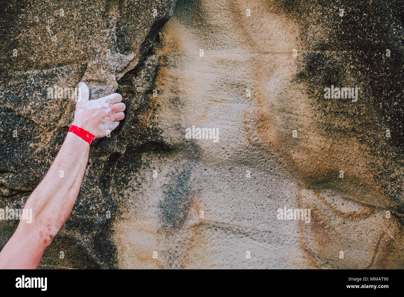 Arm of a rock climber man with scars and bounds and red wristband ...