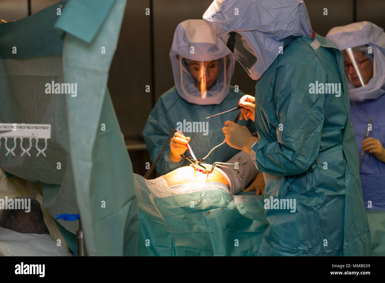 HIP PROSTHESIS, SURGERY Stock Photo - Alamy