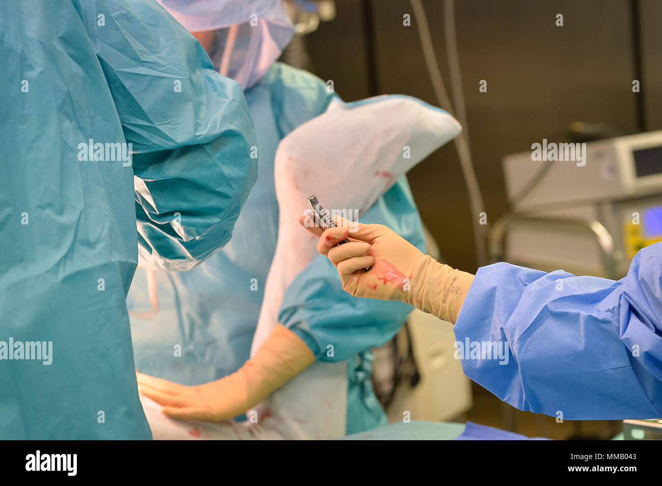 HIP PROSTHESIS, SURGERY Stock Photo - Alamy