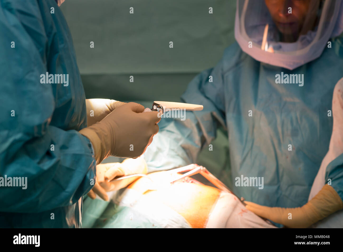 HIP PROSTHESIS, SURGERY Stock Photo - Alamy