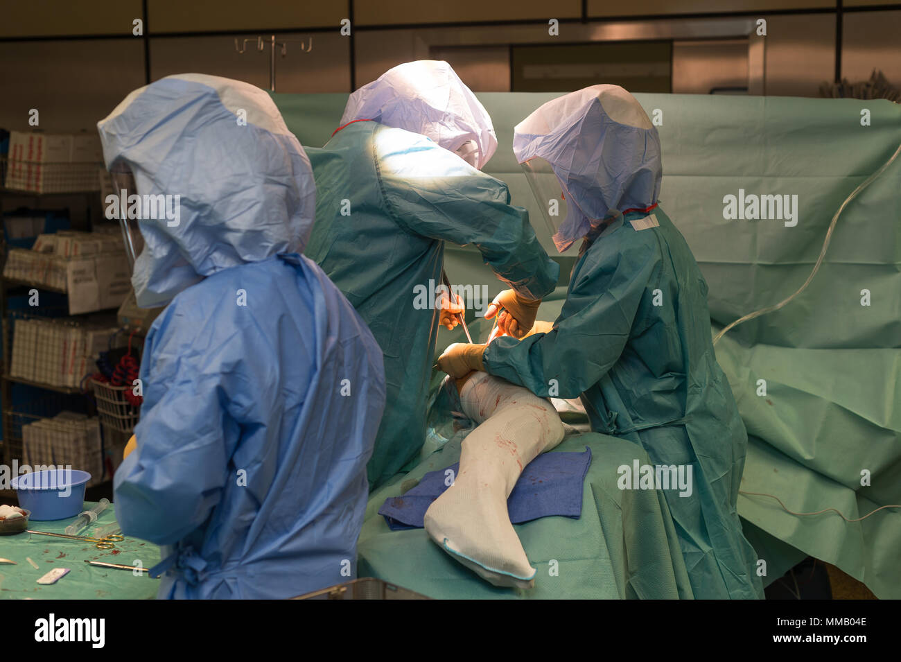 HIP PROSTHESIS, SURGERY Stock Photo - Alamy