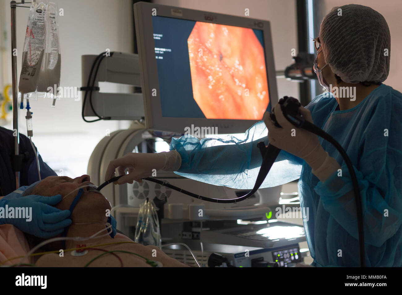 Gastrostomy hi-res stock photography and images - Alamy