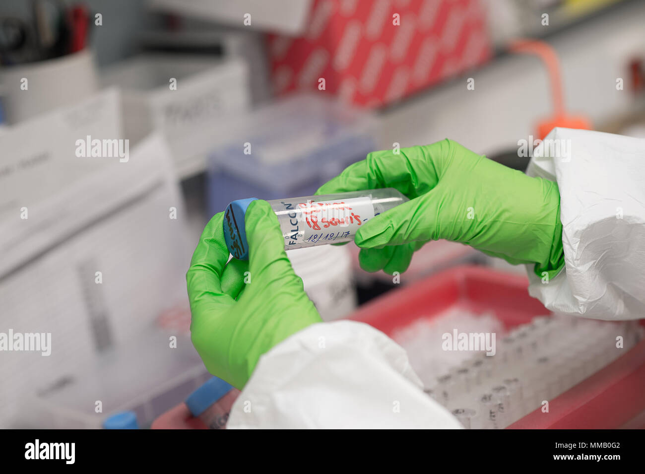 Human liver lab hi-res stock photography and images - Alamy