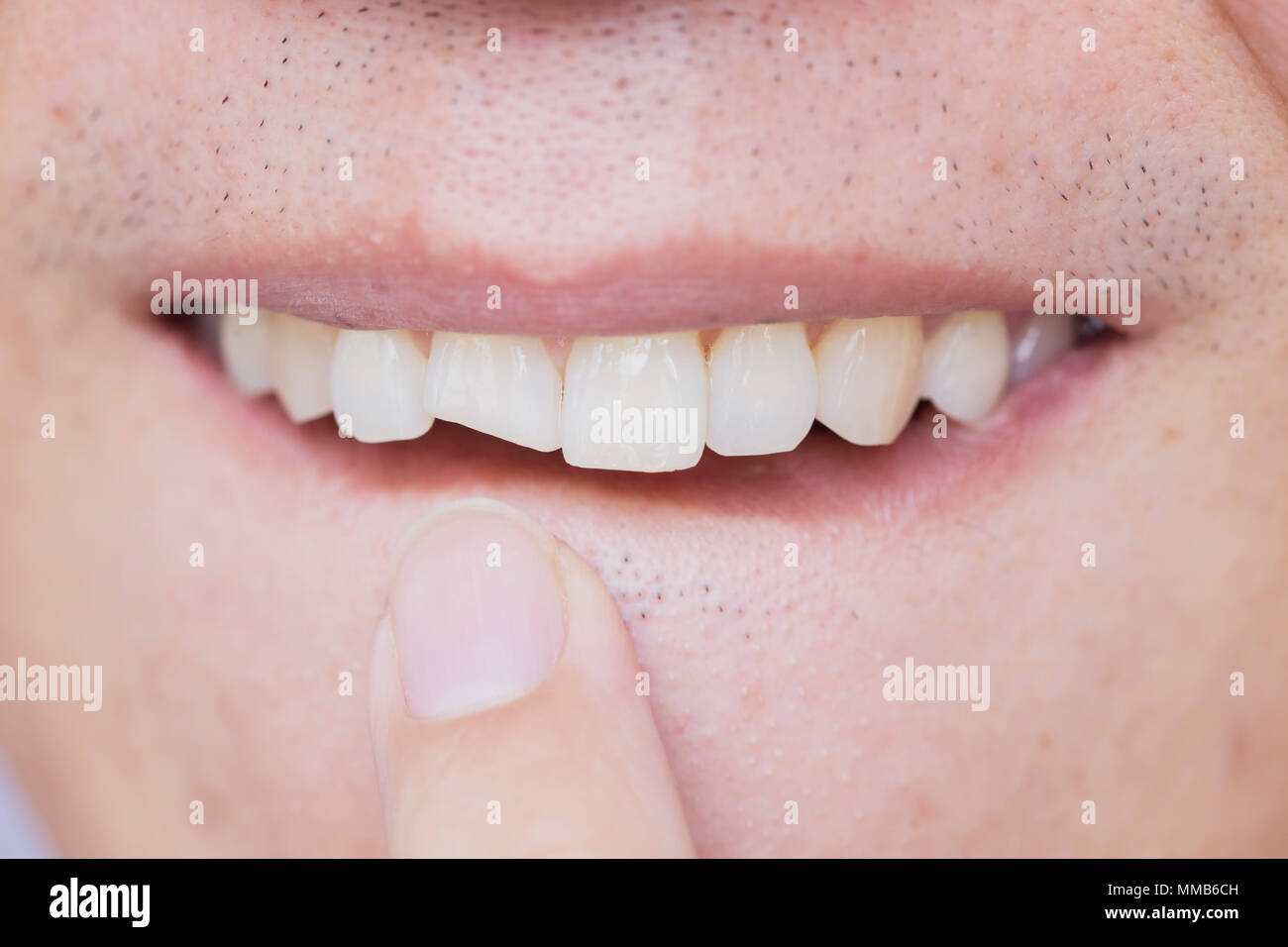 Crack cracked face hi-res stock photography and images - Alamy