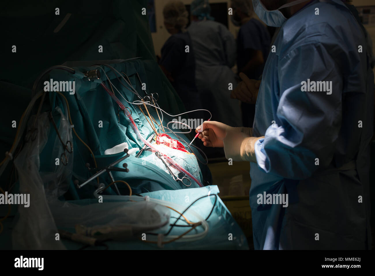 AWAKE BRAIN SURGERY Stock Photo - Alamy