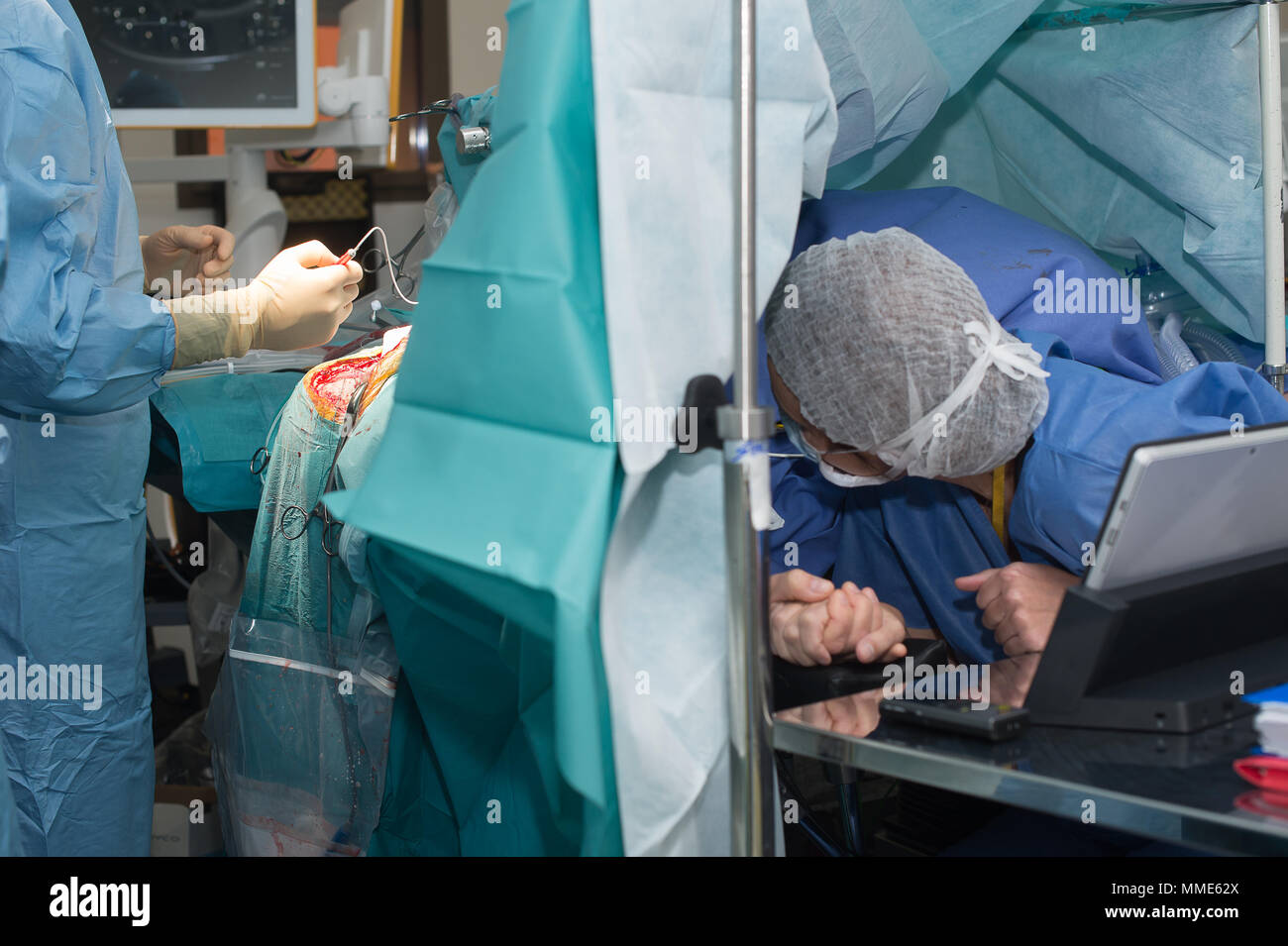 AWAKE BRAIN SURGERY Stock Photo - Alamy