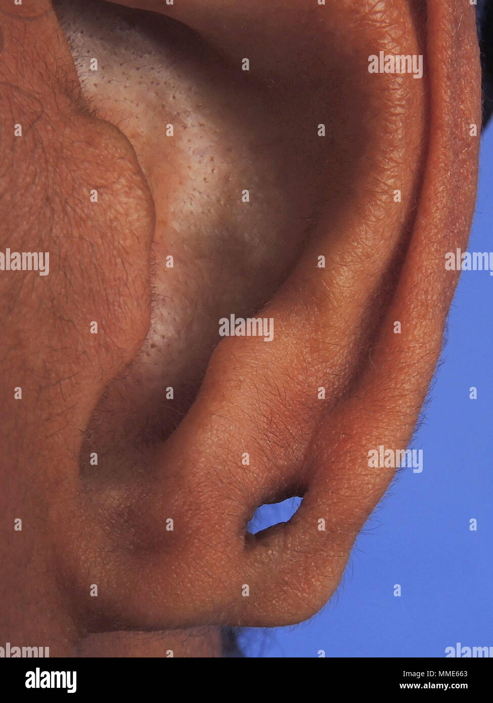 Ear Lobe Piercings High Resolution Stock Photography and Images - Alamy