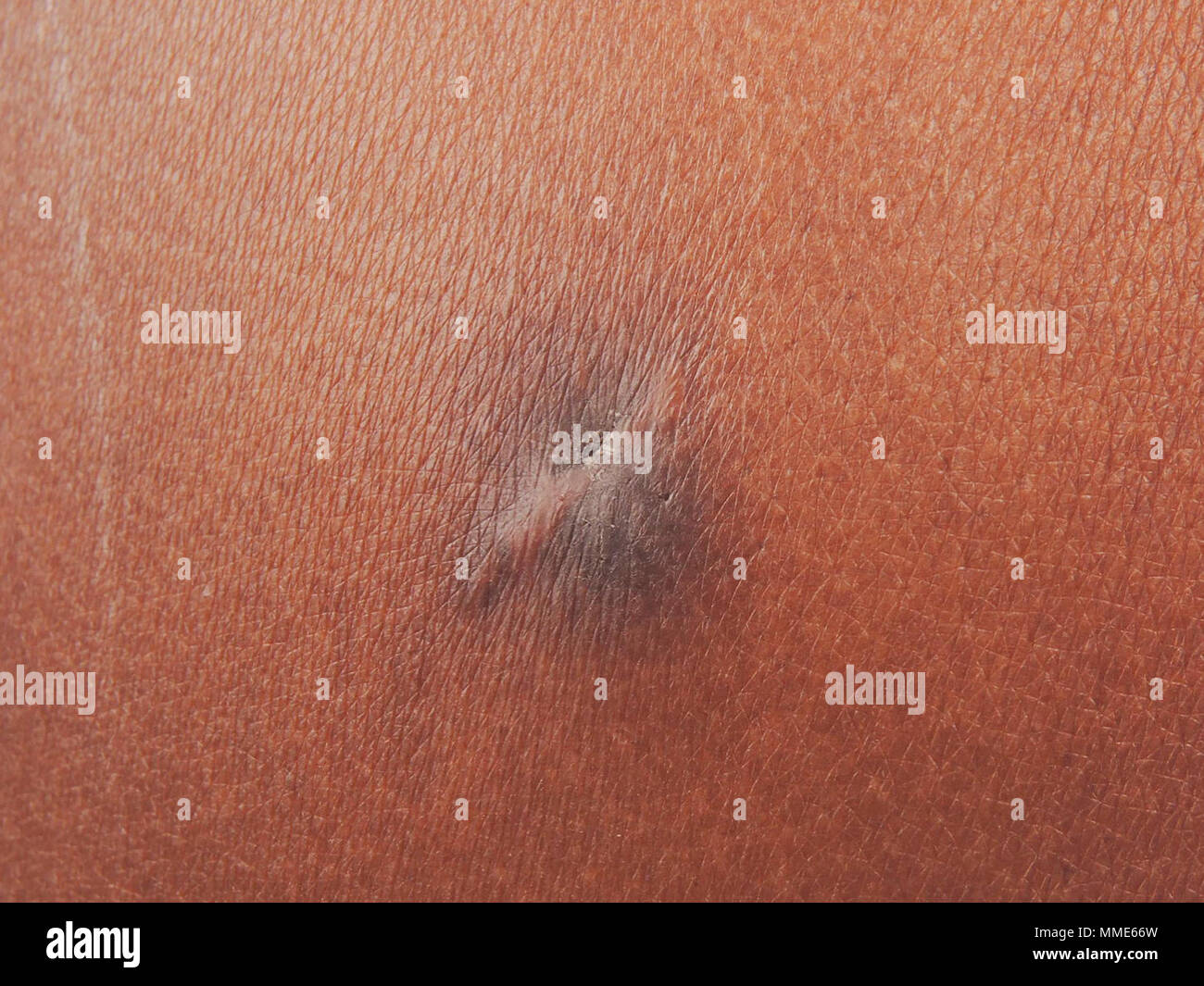 Fibrous hi-res stock photography and images - Alamy