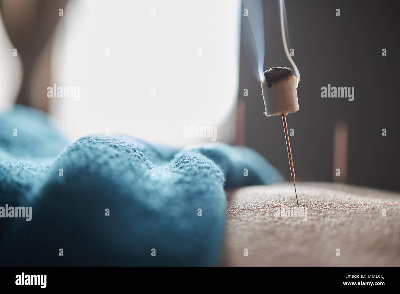 Single needle acupuncture hi-res stock photography and images - Alamy