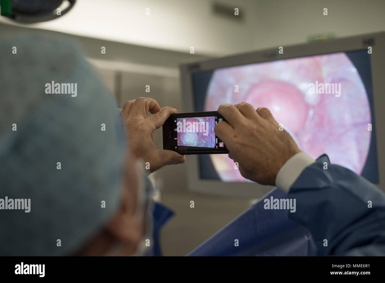 Endometriosis laparoscopy surgery hi-res stock photography and images ...