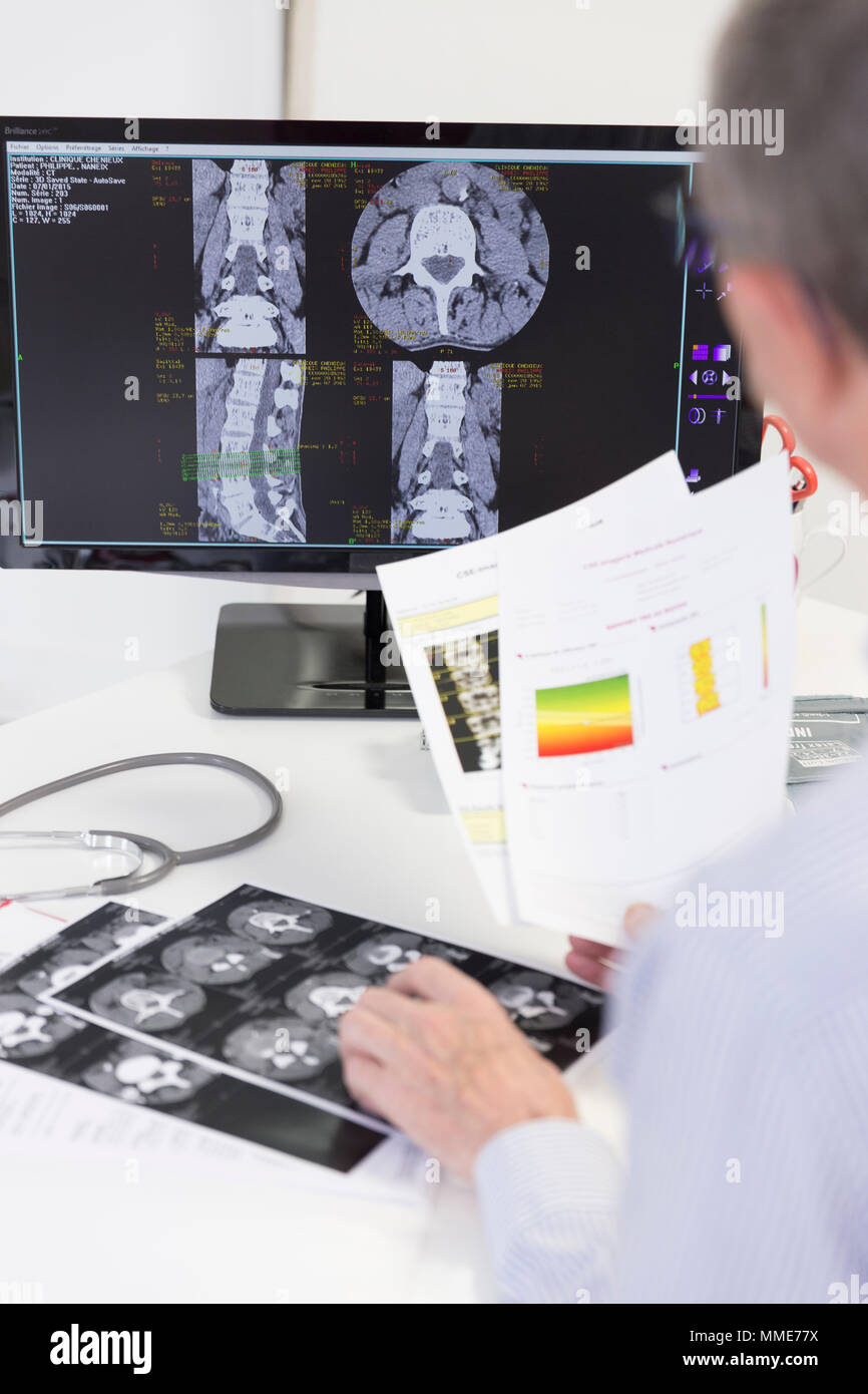 Bone density scan results hi-res stock photography and images - Alamy