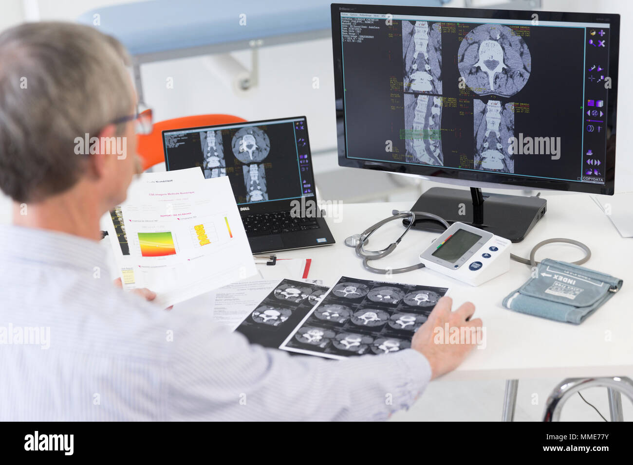 Bone density scan results hi-res stock photography and images - Alamy