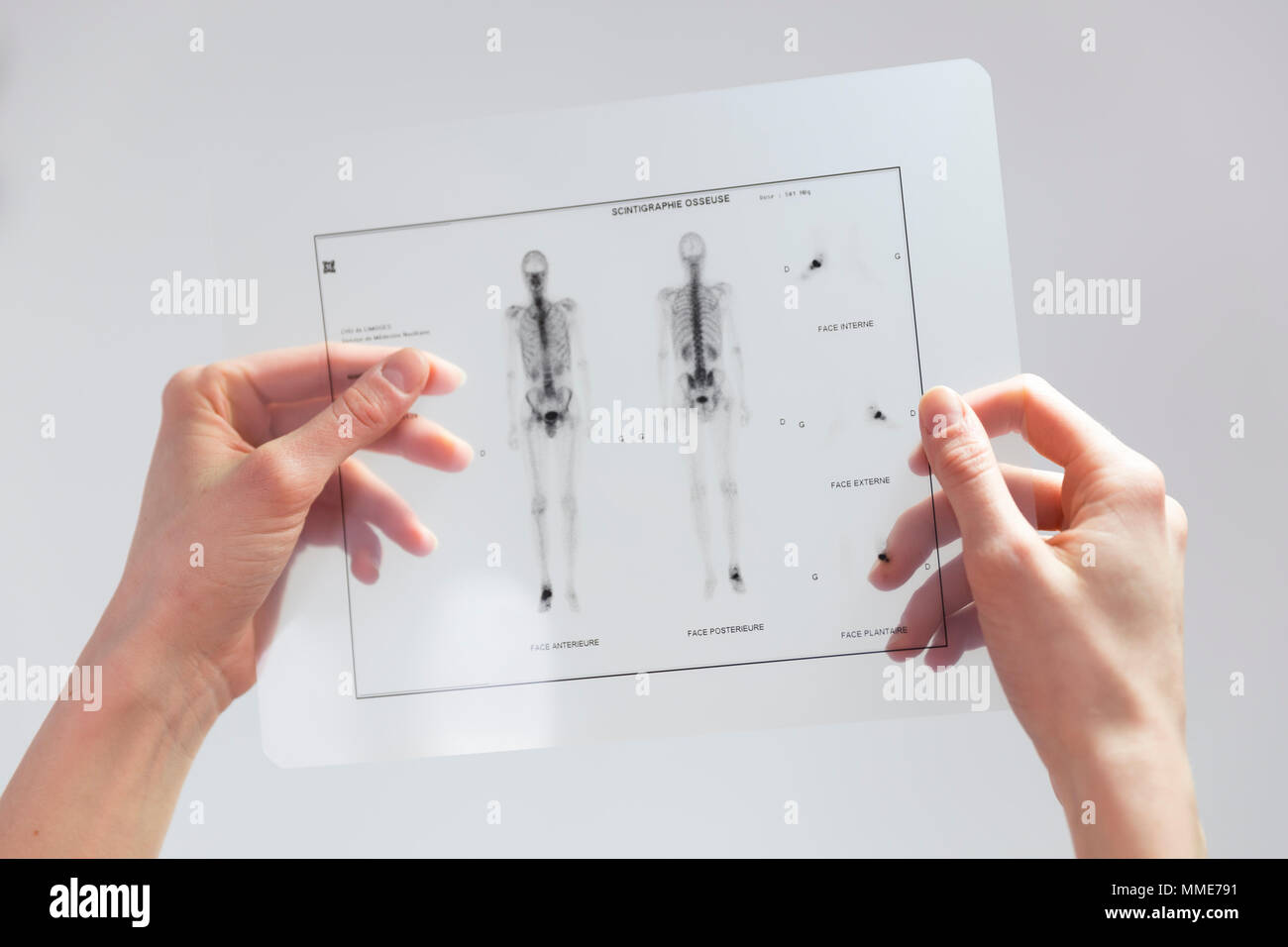 Whole body hi-res stock photography and images - Alamy