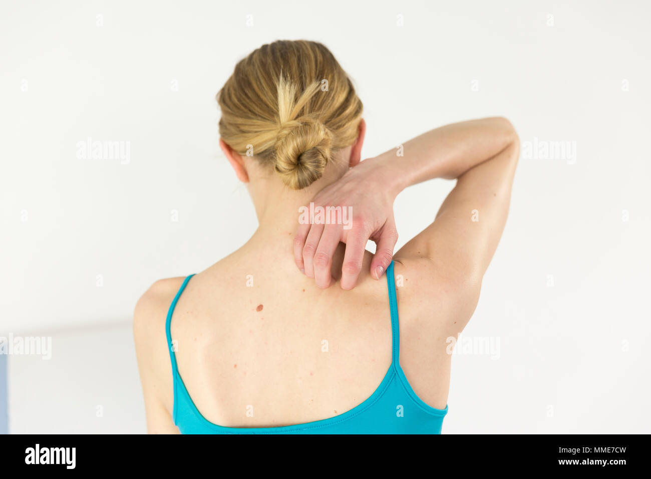 Woman scratching back hi-res stock photography and images - Alamy