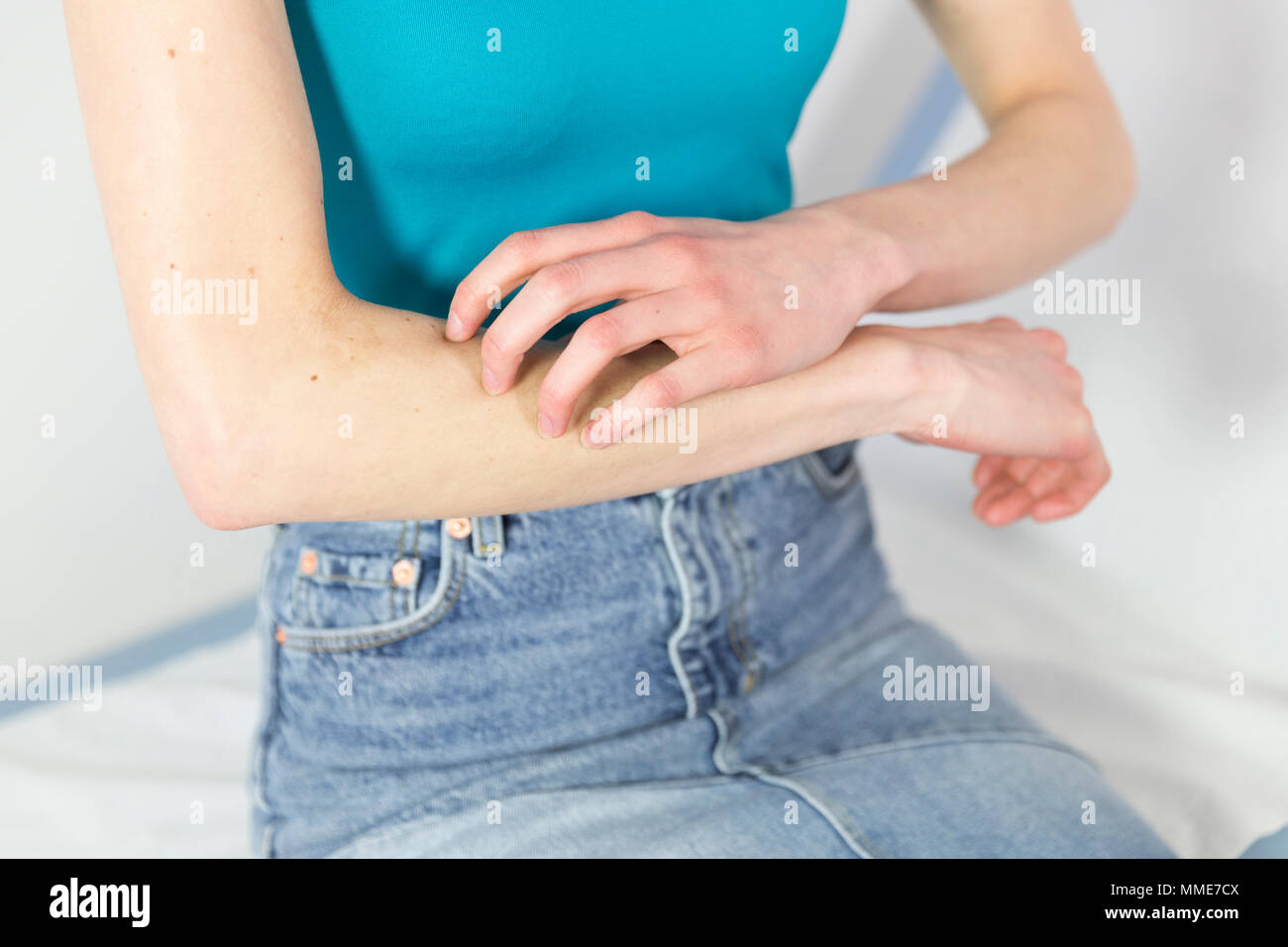 ITCHING IN A WOMAN Stock Photo - Alamy