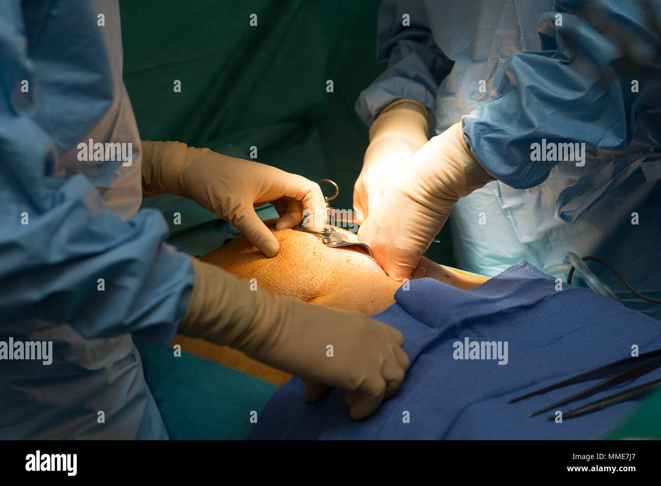 Health hospital operating theatre transplants hi-res stock photography ...