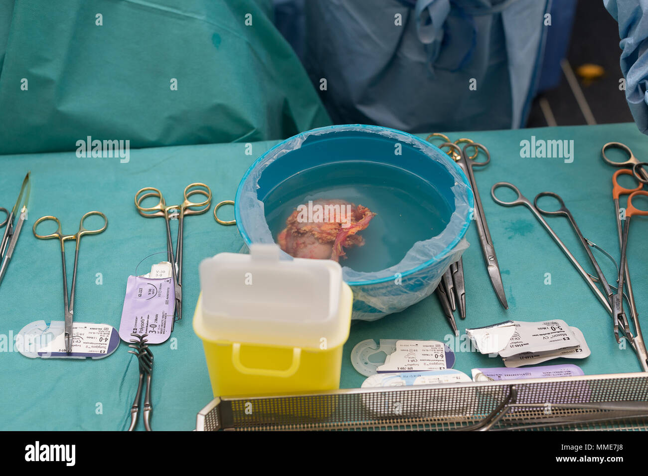Kidney transplant hi-res stock photography and images - Alamy